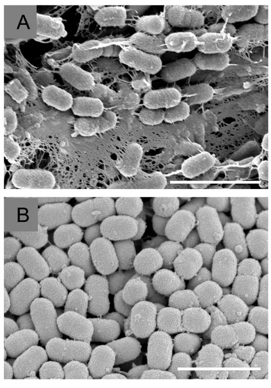 Les entérotypes microbiens intestinaux forment un spectre plutôt que des groupes distincts 4061_2