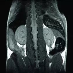 Visualisasi mouse non-invasif dening Magnetic Resonance Imaging