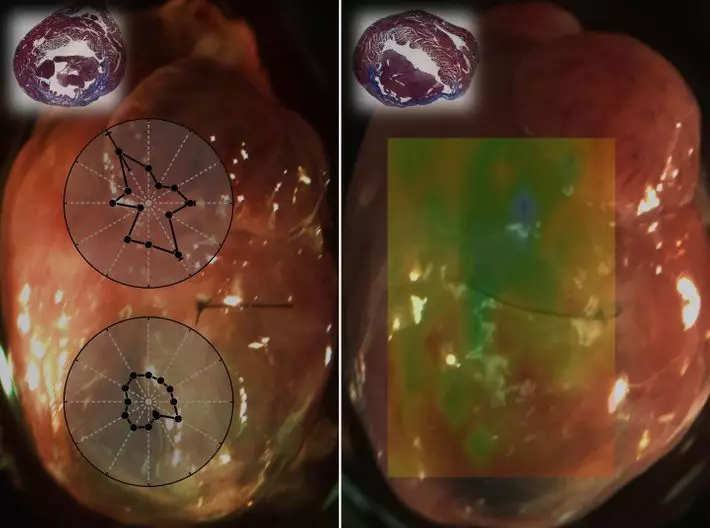 New Mapping Method Aids Entwécklung vun Therapien fir beschiedegt Häerz Tissue