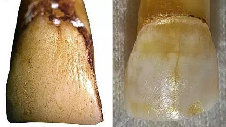 Koshima Adası Makak ve Neandertal Dişleri