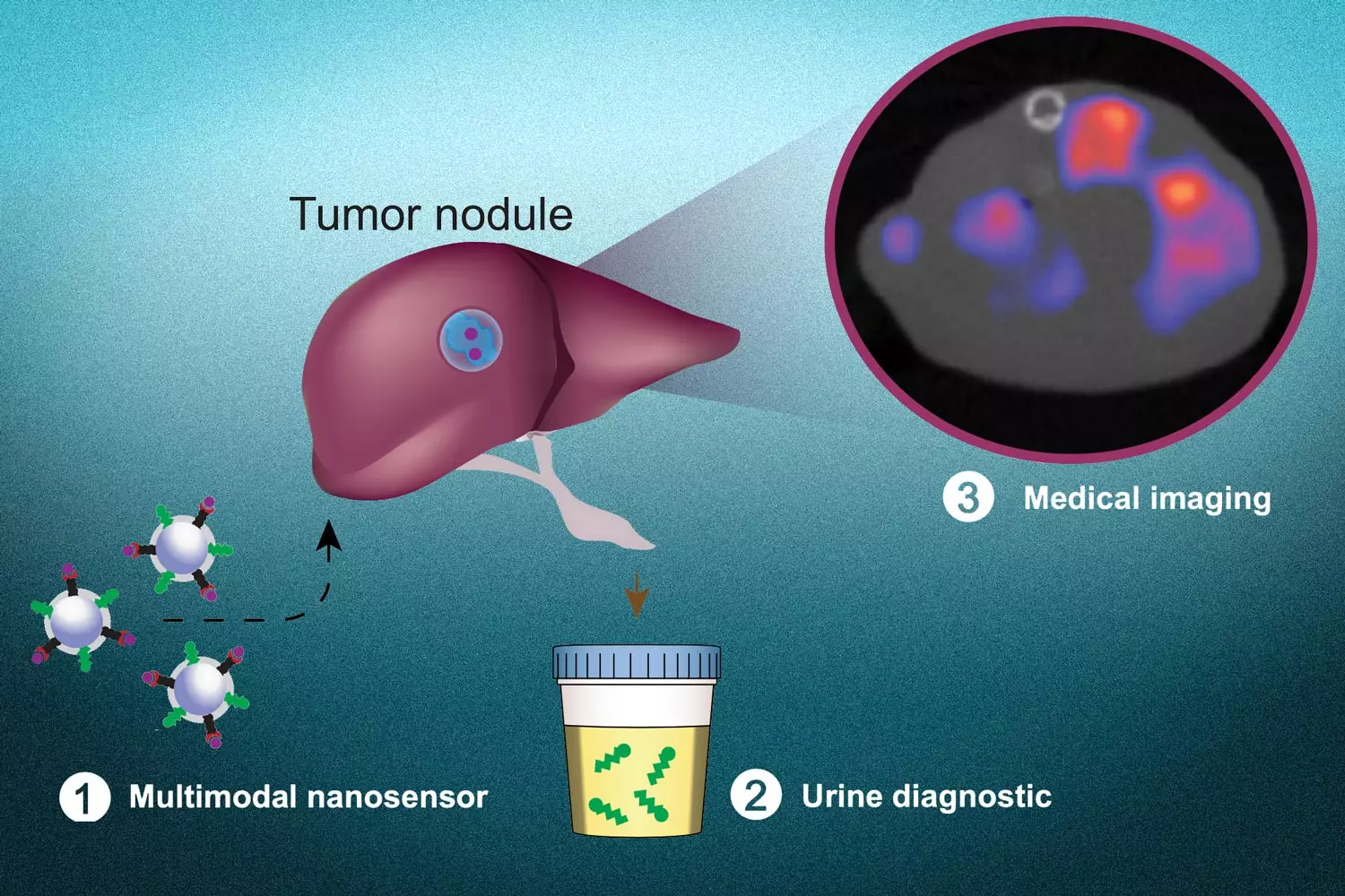 कर्करोगाच्या पेशी शोधण्यासाठी आणि त्यांचे स्थान निश्चित करण्यासाठी नॅनोकणांचा वापर करून एक नॉन-आक्रमक चाचणी