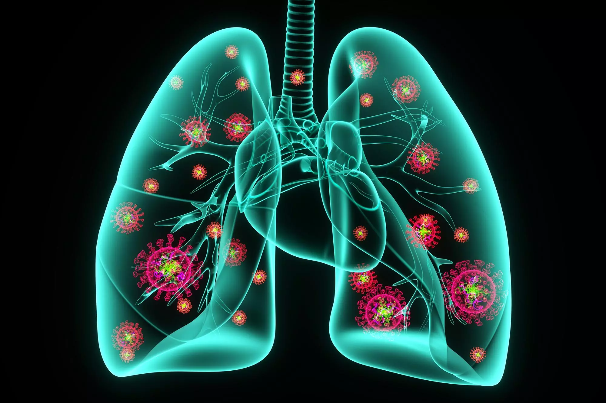 "Som flera skogsbränder" - Varför COVID-19 varar längre, orsakar mer skada än vanlig lunginflammation