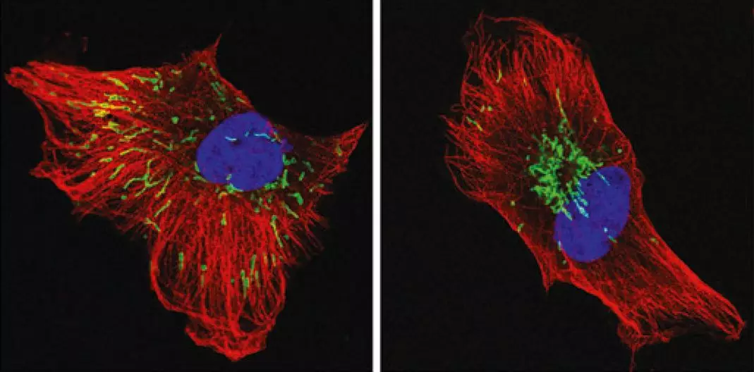 Mitochondria Bulala iiseli zomhlaza