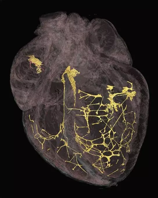 טכניקת רנטגן לזיהוי סיבי רקמה בלב