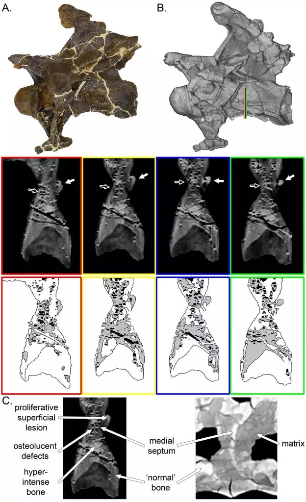 Indwara ya Dinosaur Vertebrae