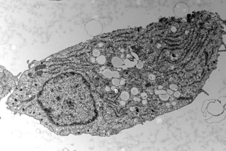 Pancreas betacelle