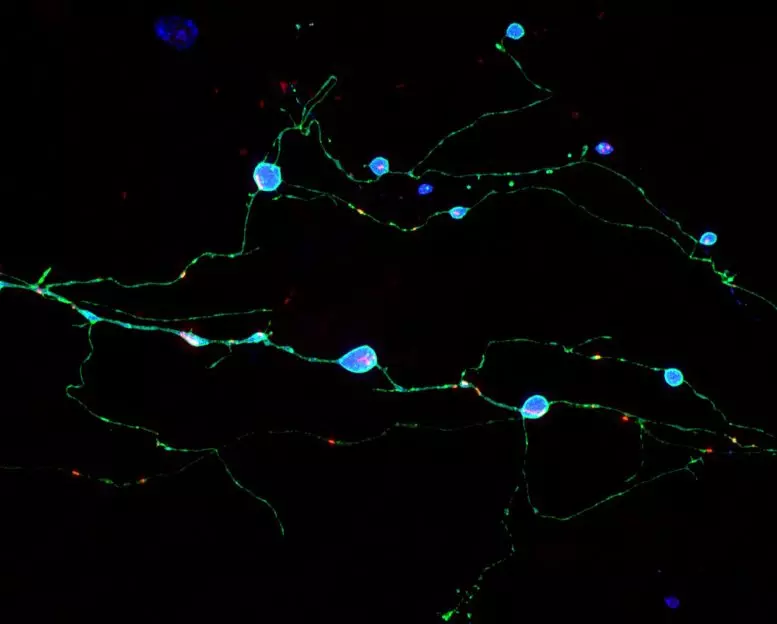 Mga Neuron nga Nagpahayag sa Mutant Prion Protein