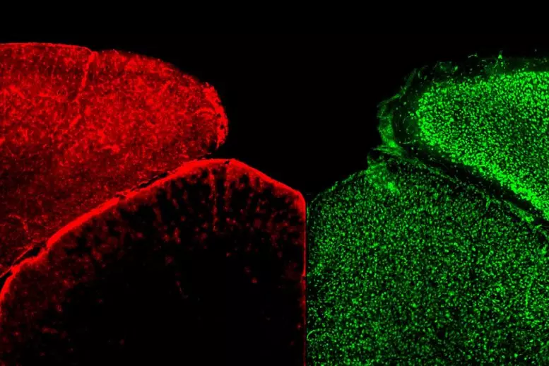 Astrociti i neuroni dobivaju novi izgled