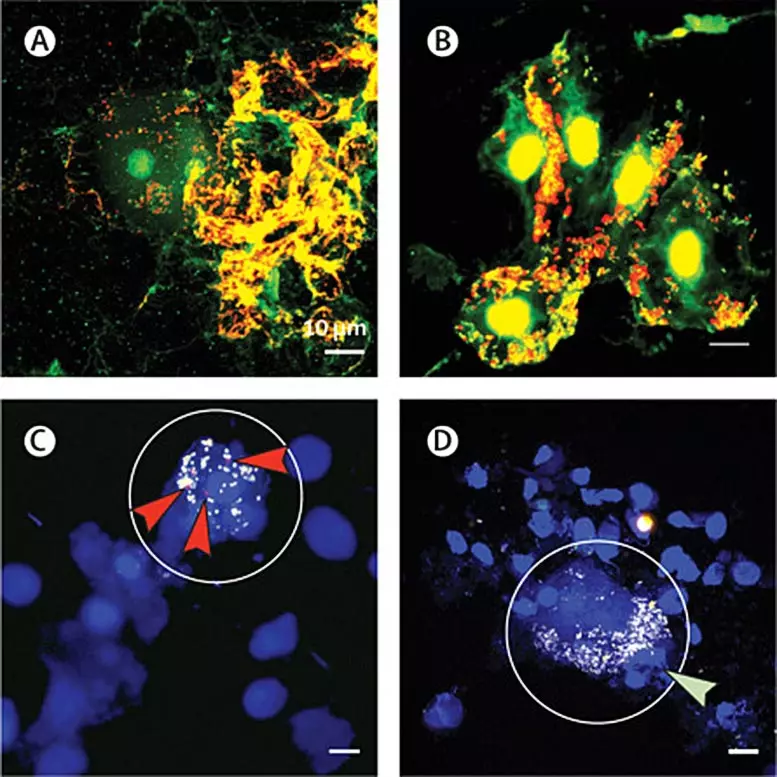 Plateepitelcellebiofilmer