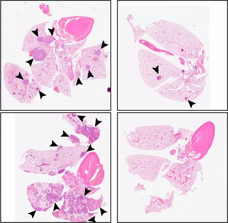 C26 waxay xakameysaa metastasis-ka