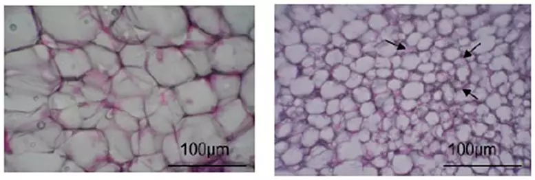 Flavanols सह फॅट ब्राउनिंग