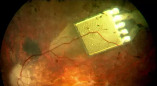 Фотоволтаичните импланти на ретината, комбинирани с видеоочила, могат да възстановят зрението 6093_1