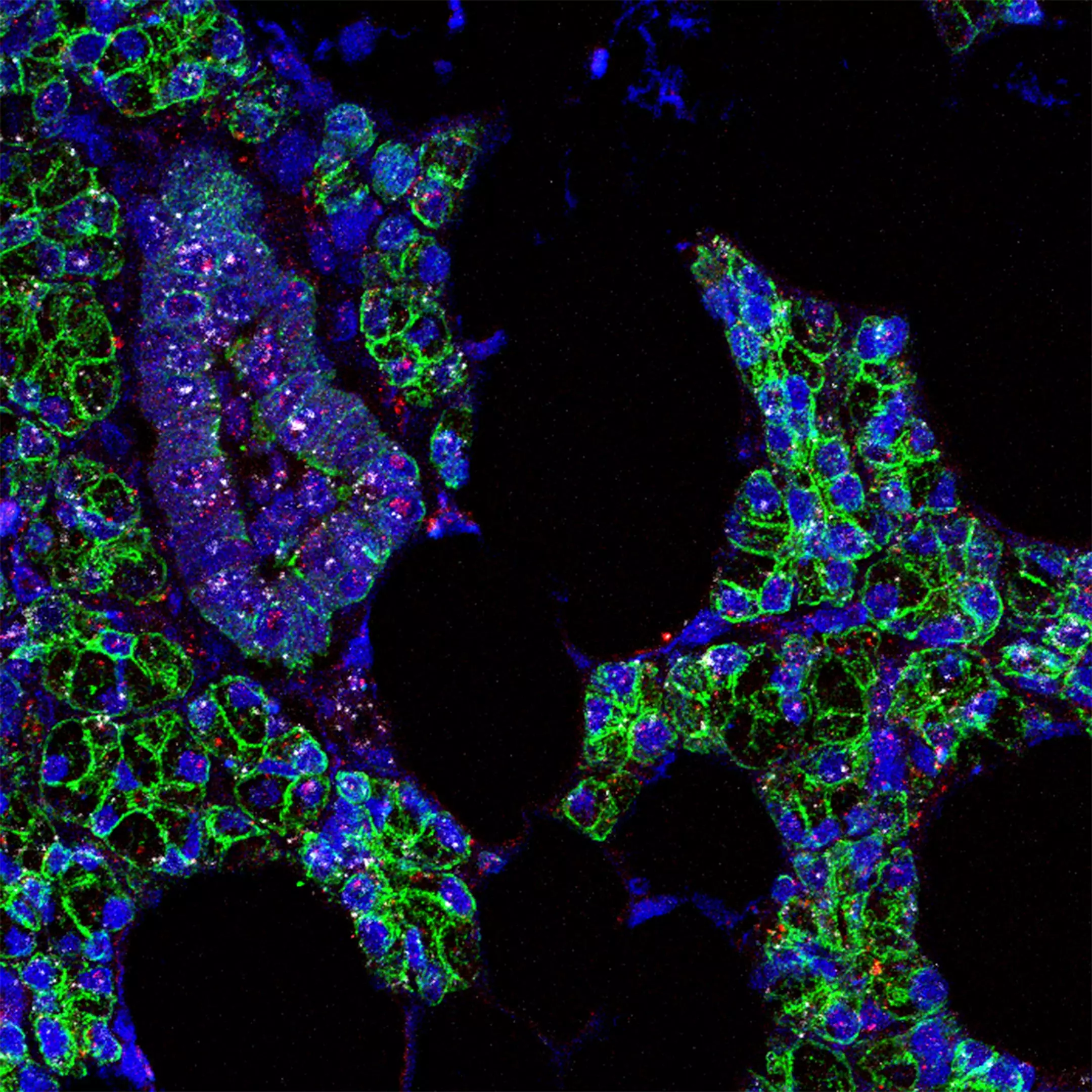 Gli scienziati trovano prove che il nuovo coronavirus infetta le cellule della bocca: la saliva può avere un ruolo nella trasmissione di COVID