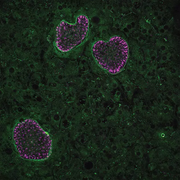 新しい技術により、研究者は新しい抗マラリア薬を開発およびテストすることができます