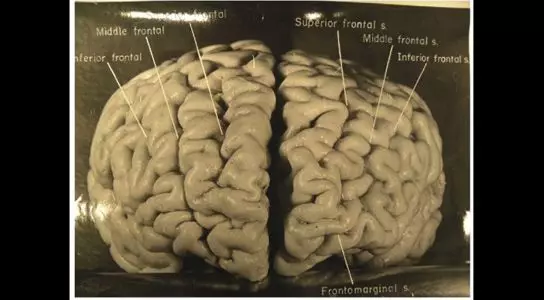 Fotografije Einsteinovog mozga pokazuju jedinstvene karakteristike 6486_1