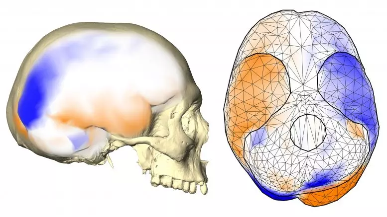 Endocast humano