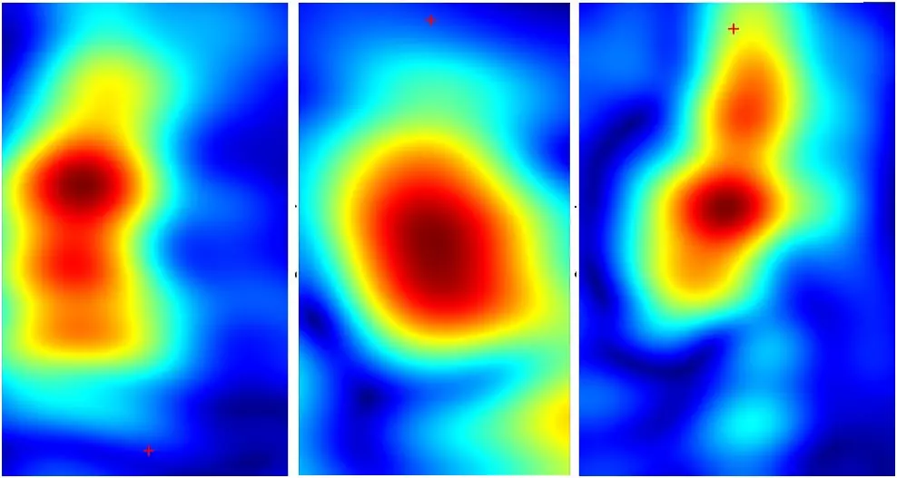 Ciao, ciao, biopsia? Dispositivo portatile con nuova tecnologia di imaging per identificare in modo indolore i tumori della pelle