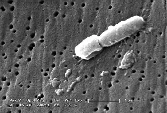 CDC greinir frá því að Superbug NDM-1 dreifist á sjúkrahúsi í Bandaríkjunum 7230_2