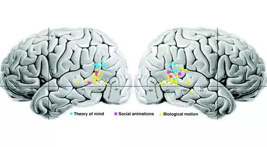 Une mystérieuse mutation génétique ouvre une fenêtre sur la biologie de la cognition du langage 7269_1