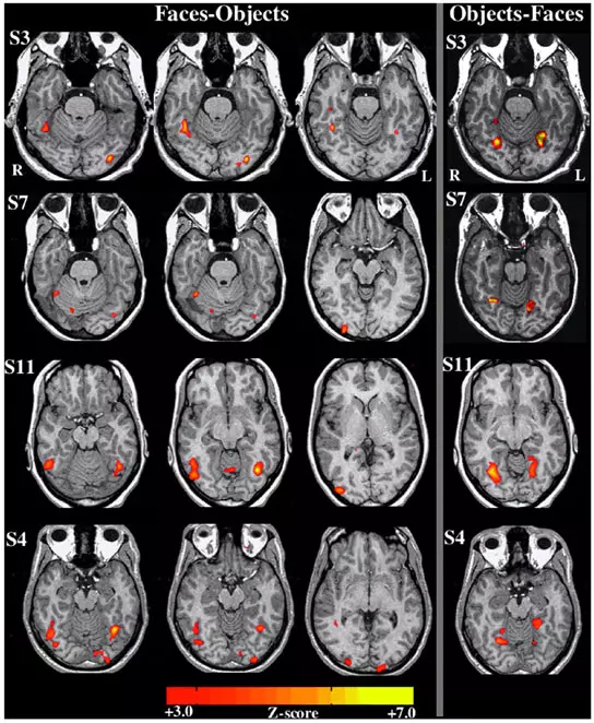 Une mystérieuse mutation génétique ouvre une fenêtre sur la biologie de la cognition du langage 7269_2