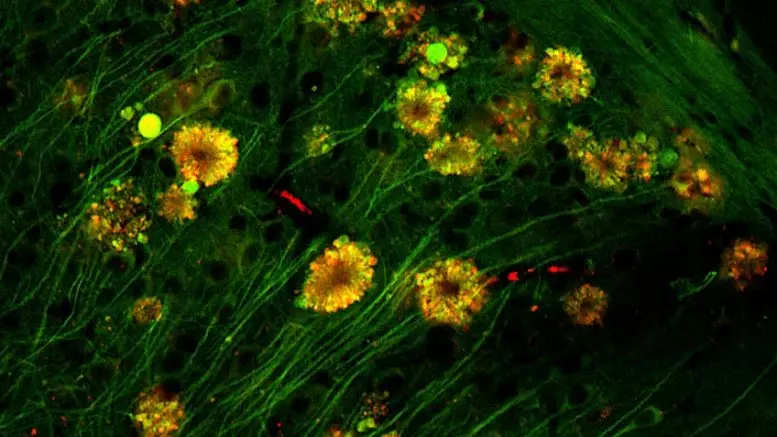 Ruva-Senge Maumbirwo eAutophagic Vacuoles muAlzheimer's Disease Neurons