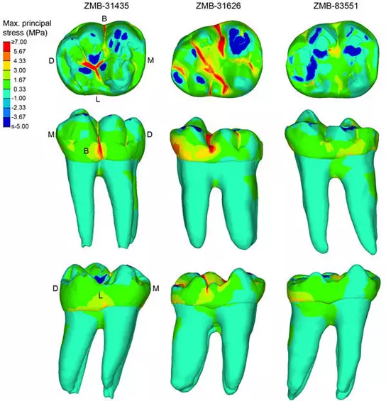 Biomécanique des caractéristiques dentaires et usure des dents