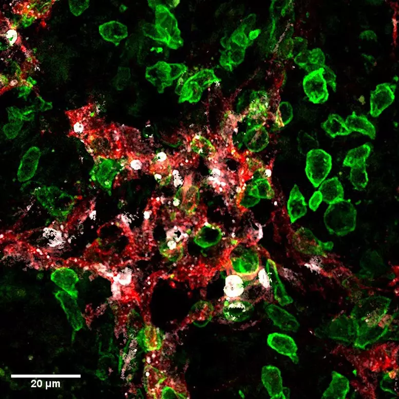 La doble ventaja de las células T asesinas para prevenir las metástasis del cáncer