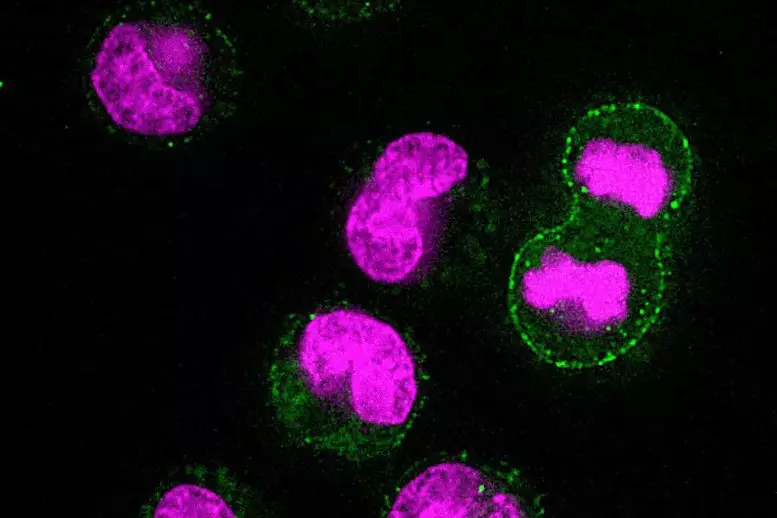 Cellen Lysosomale exocytose