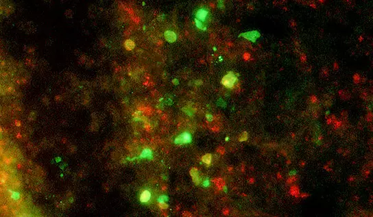 Virus ødelegger sikkert hjernesvulster