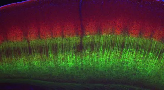 Ngontrol Thalamus kanthi Sinapsis Dinamis