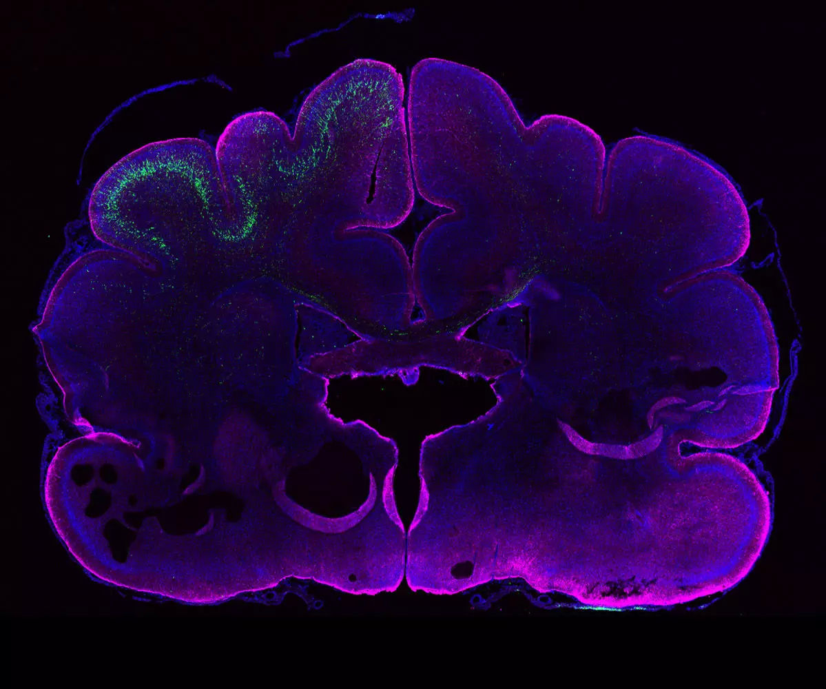 Os investigadores descobren un xene específico do ser humano para construír un cerebro máis grande