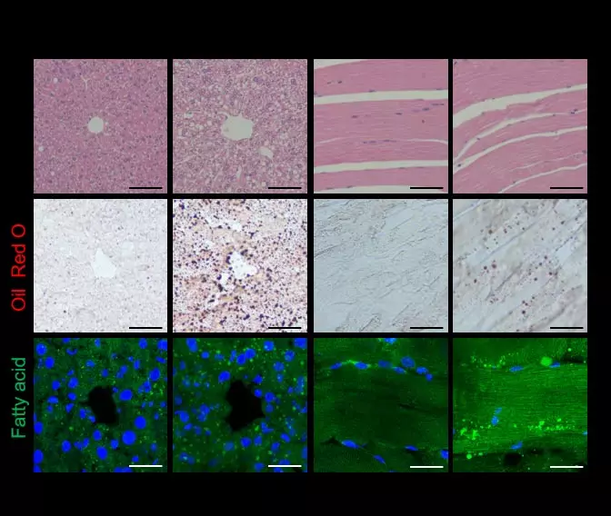 मॉर्फोलॉजी आणि यकृत आणि स्नायूमध्ये चरबी जमा करणे