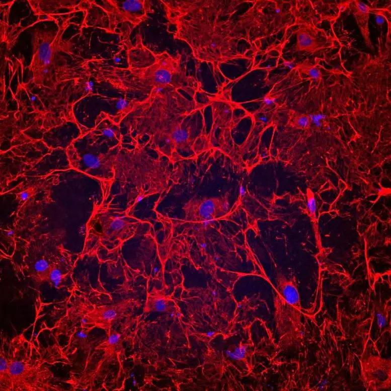 Thaiv Matrix-Forming Protein tuaj yeem tiv thaiv lub plawv tsis ua haujlwm